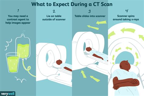 CT Scan Utilisations effets secondaires procédure résultats