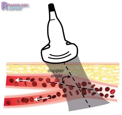 Ultrasound Technique