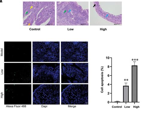 β Sitosterol Inhibits The Proliferation Of Endometrial Cells Via