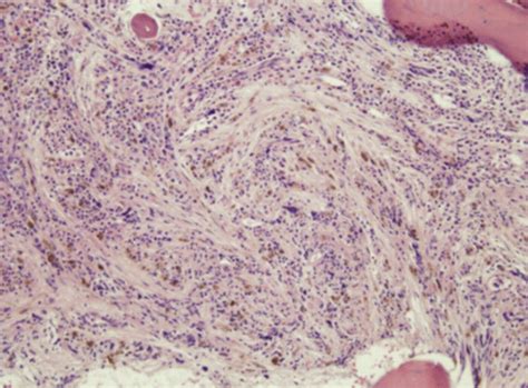 Anemias Part Iii Normocytic Anemias Flashcards Quizlet
