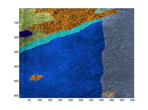 Segmentation Given By Two Experts Download Scientific Diagram