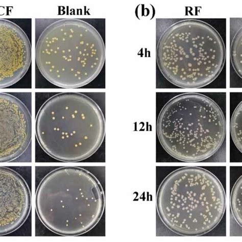 The Proliferation Results Of A Sa And B Li After Co Cultured