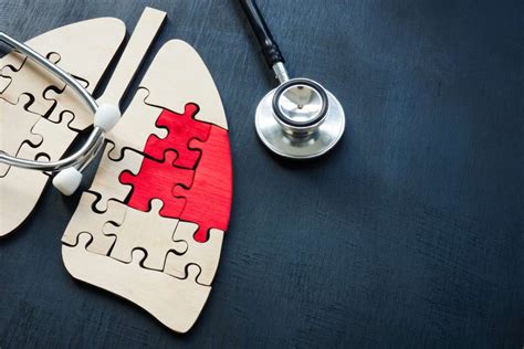 Why Are Young Adults And Nonsmokers Getting Lung Cancer Ucla Health