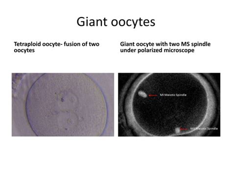 Oocyte And Embryo Grading Blastocyst Gradingpptx