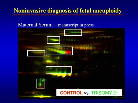 Ppt Prenatal Diagnosis And Aneuploidy Screening Diagnostico Prenatal