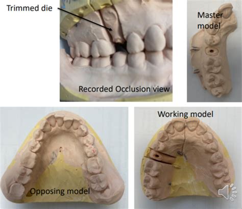Die Trimming And Model Margin Management Flashcards Quizlet