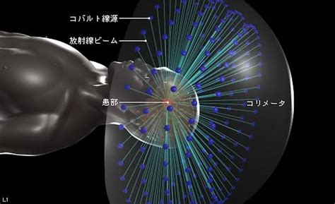 実は進化していた放射線治療とよくある相談事例 がんメディ
