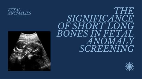 The Significance Of Short Long Bones In Fetal Anomaly Screening