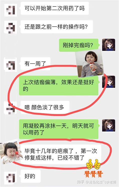 十几年的腋下手术疤痕，十几天的修复效果对比 知乎
