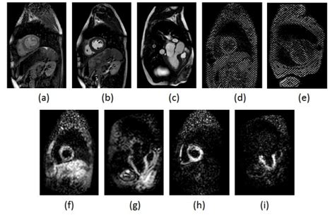 Classification Of Cardiac Magnetic Resonance Image Type And Orientation Biotechnology School