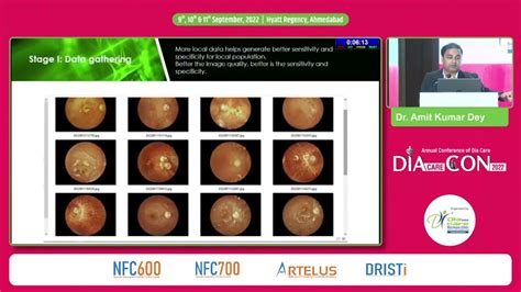 Dr Amit Kumar Dey Role Of Ai In Screening Of Diabetic Retinopathy