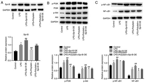 Polydatin Significantly Reduces Spi B Expression And Counteracts