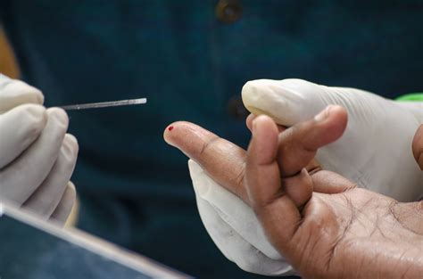 Teste Rápido Da Covid 19 Deve Ser Feito 8 Dias Após Início De Sintomas