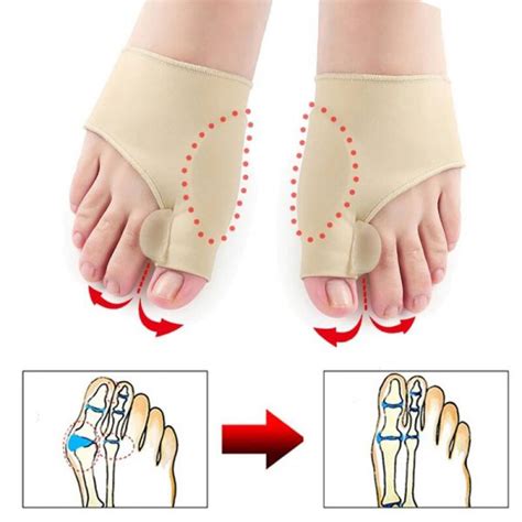 Foot Toe Correction Brace Buy Online 75 Off Wizzgoo Store