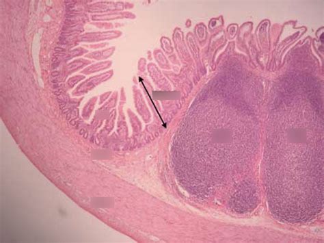 Week Ileum Histology Diagram Quizlet