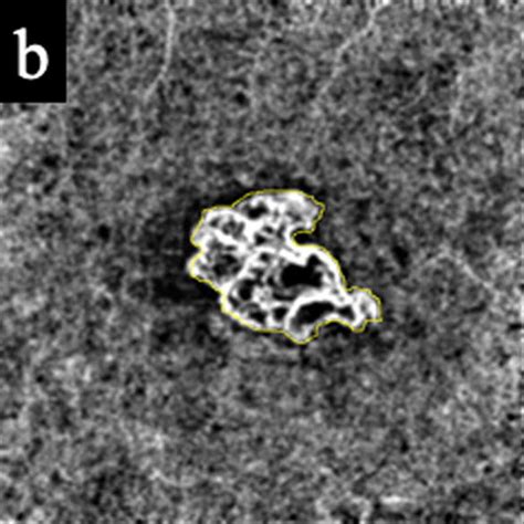 Noise Component Comparisons Band Pass Filter Bpf Processing By Fast