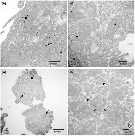 Immunoelectron Microscopy Plos One