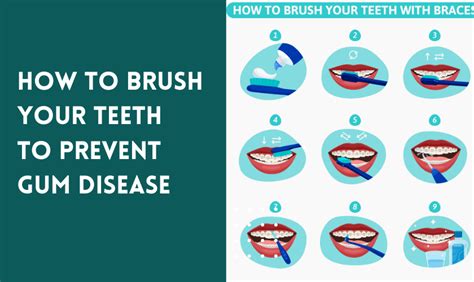 How To Brush Your Teeth Properly Step By Step With Pictures At Misty Harris Blog