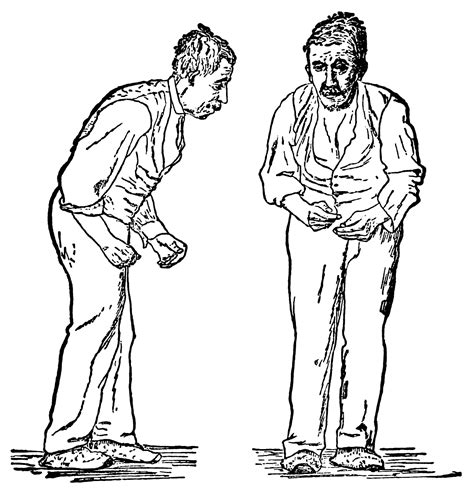 Free Parkinsons Disease Cliparts Download Free Parkinsons Disease