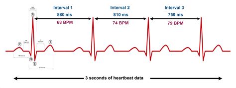 Heart Rate Variability Metrics Explained Wellhero