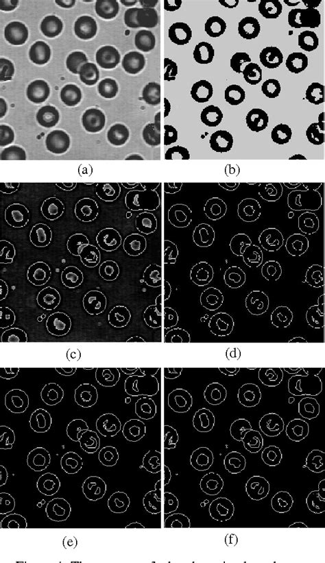 figure 1 from method of edge detection based on non linear cellular