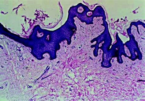 Dark Thick Nipples And Areolas SpringerLink