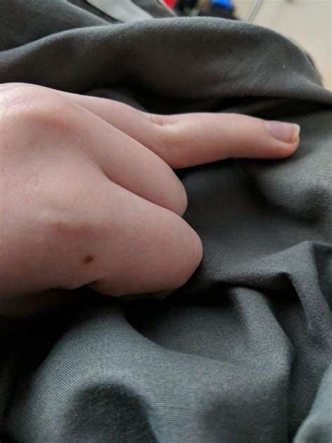 My Left Ring Fingers Knuckle Bends Backwards R Mildlyinteresting