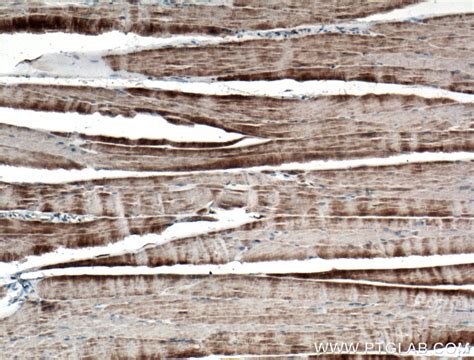 Titin Antibody 27867 1 Ap Proteintech 武汉三鹰生物技术有限公司
