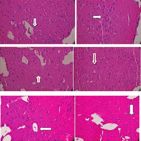 Histopathological Evaluation Of Normal Reserpine And Drug Treated