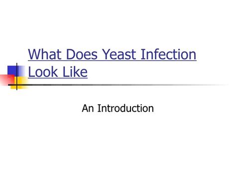 What Does Yeast Infection Look Like