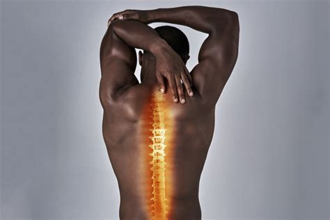 What Causes Bulging Discs All Injury Rehab