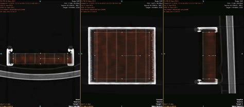 8 Exemple d une image résultante d une acquisition en tomographie Download Scientific Diagram
