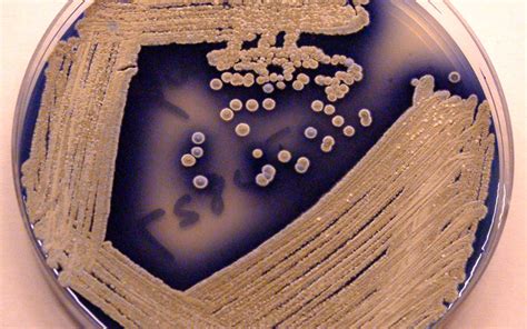 Microbiology Ucl Research Domains Ucl University College London