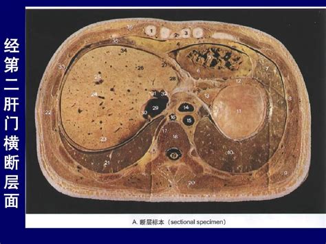 肝和胆囊的断层解剖 腹部断层解剖学人体断层解剖学 课件 11 word文档在线阅读与下载 无忧文档