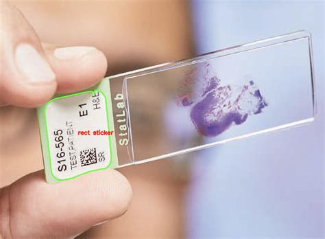 GitHub Sohankancherla Sticker Detection Identify Stickers With Text On Images Of Microscopic
