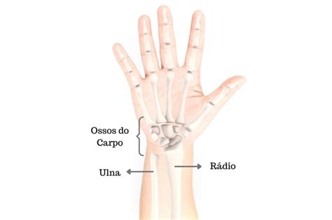 Fratura De Punho Como é A Recuperação Dra Marina Pisani