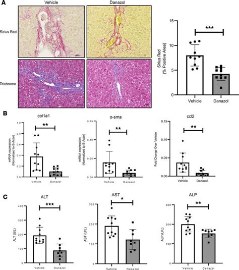 Jci Insight Telomere Dysfunction Promotes Cholangiocyte Senescence And Biliary Fibrosis In