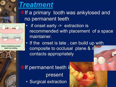 Ankylosis Of Teeth Pptx