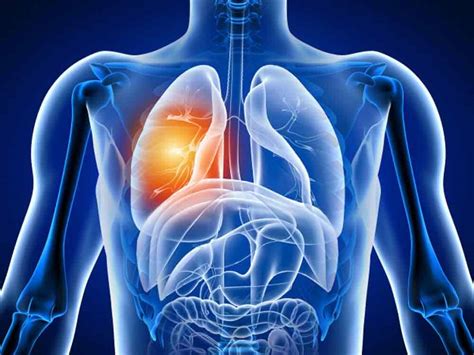 Chronic Post Covid 19 Syndrome CPCS The Gupta Program