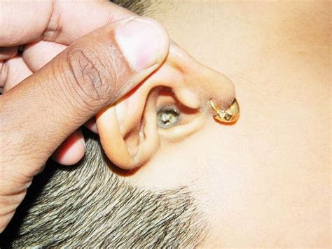 Doctors Guide On Clearing Ear Wax Blockage And Cleaning Your Ears Safely Mental Itch