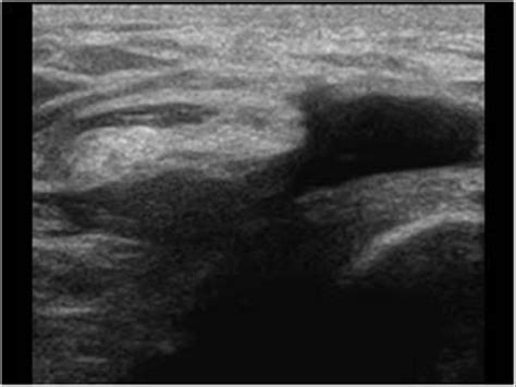 Musculoskeletal Joints And Tendons 66 Knee Case 6613 Medial Side