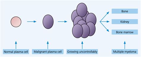 Multiple Myeloma