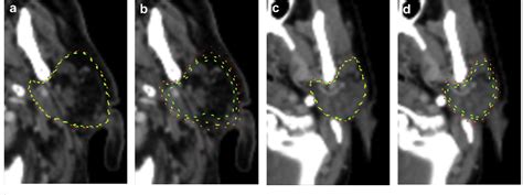 Figure From Using Spatial Probability Maps To Highlight Potential Inaccuracies In Deep