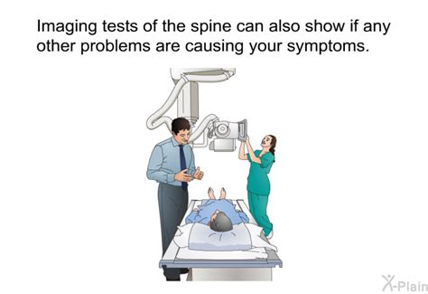 Spinal Synovial Cysts