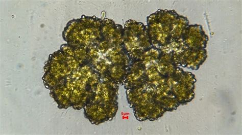 Botryococcus Braunii · Inaturalist