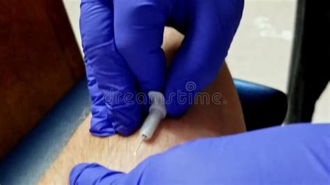 Purified Protein Derivative Ppd Subcutaneous Injection Stock Footage