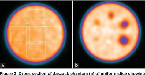 Figure 2 From Evaluation Of External Beam Hardening Filters On Image Quality Of Computed