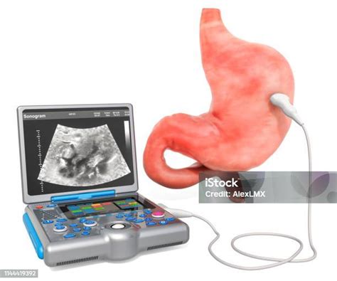 소화 초음파 개념 의학 초음파 진단 기계 백색 배경에 고립 된 3d 렌더링을 가진 인간적 인 위 3d 스캔에 대한 스톡 사진 및 기타 이미지 Istock