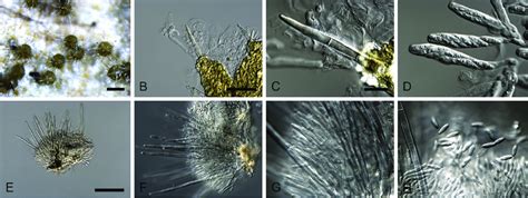 Pseudonectria Buxi Cbs 324 53 A Ascomata On The Leaf Of Buxus Download Scientific Diagram