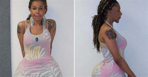 Fake Butt Doctor Sentenced To 10 Years For Patients Death Huffpost